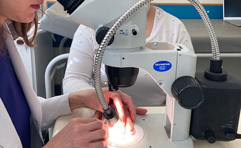 Você sabe o que é Capilaroscopia Periungueal? — Dra. Daniela Moraes