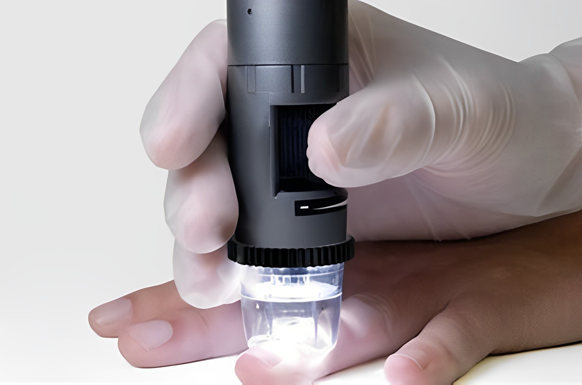 Exame de Capilaroscopia Periungueal — Dra. Daniela Moraes